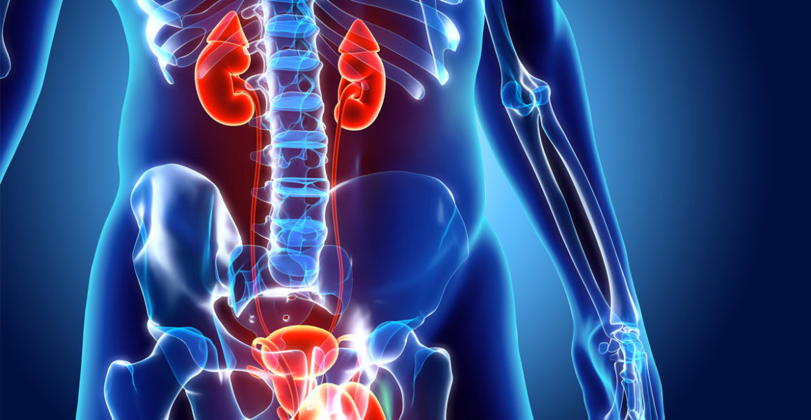 Artificial Urinary Sphincter