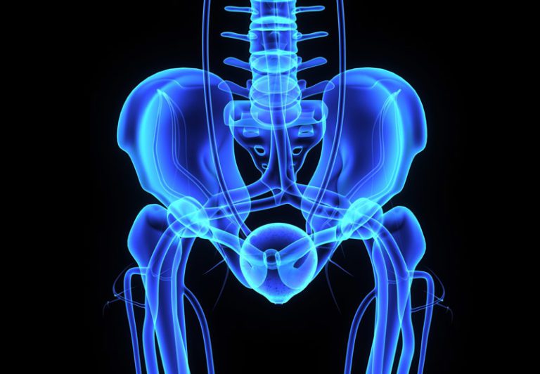 Microscopic Cord Denervation for Scrotal Pain